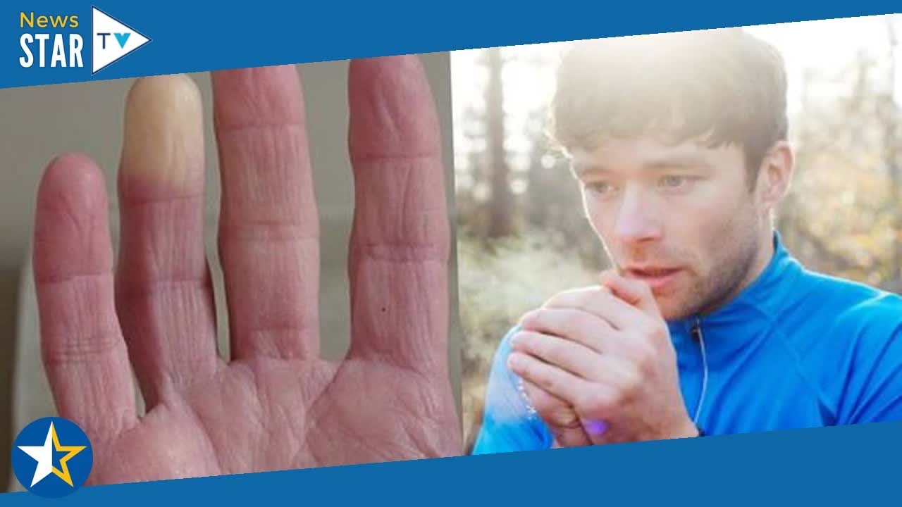 Raynaud's Disease symptoms: Does Raynaud's affect your heart? - YouTube