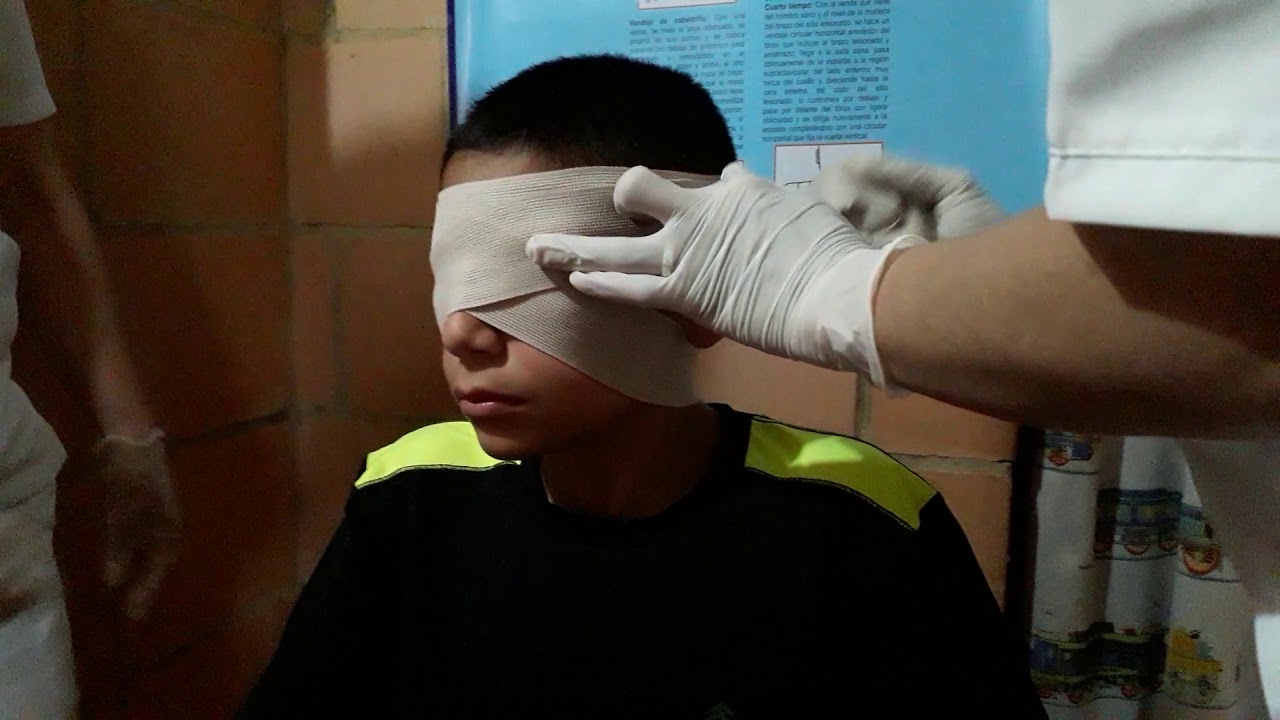 VENDAJE BINOCULAR. - YouTube