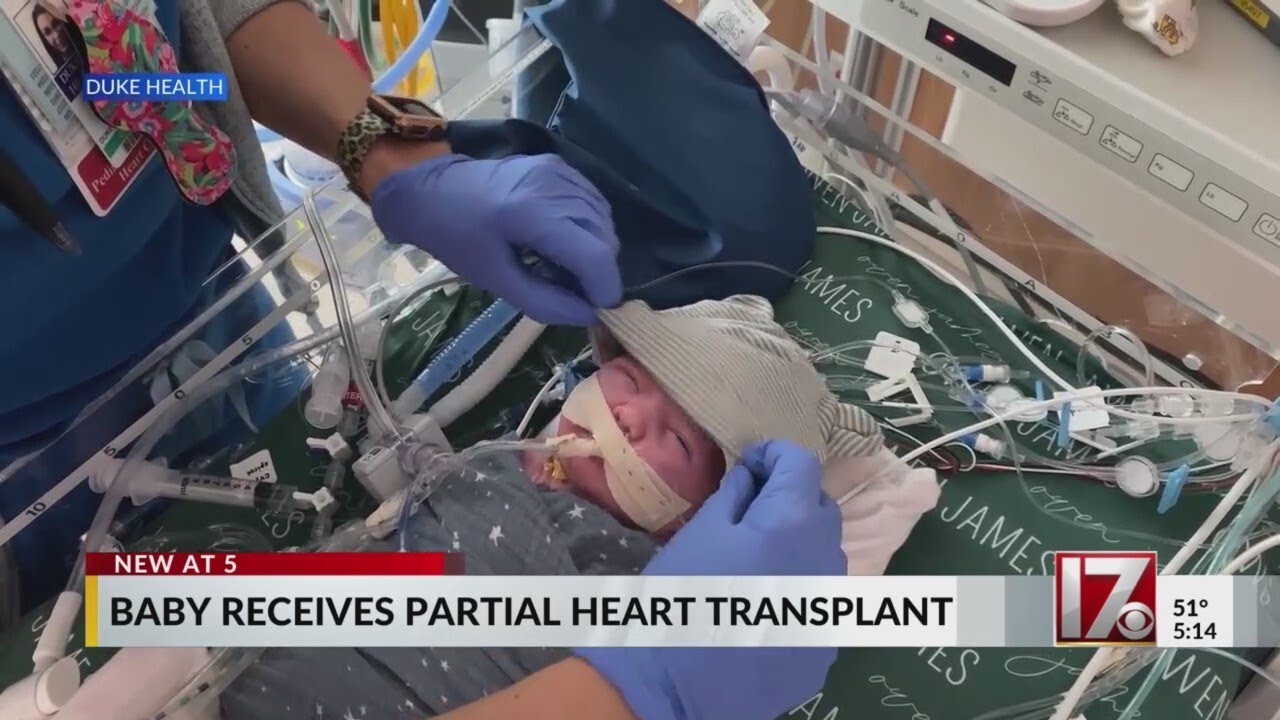 Baby receives partial heart transplant - YouTube