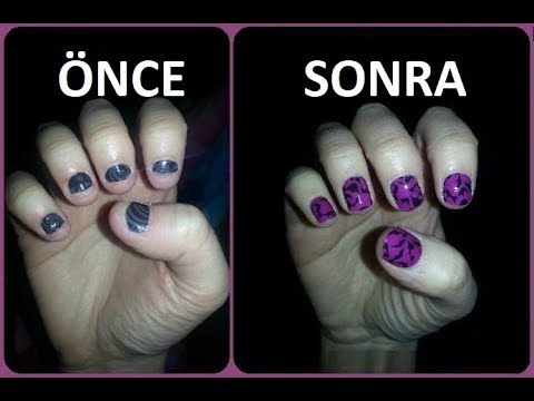 3 GÜNDE TIRNAK YEMEYİ NASIL BIRAKTIM?