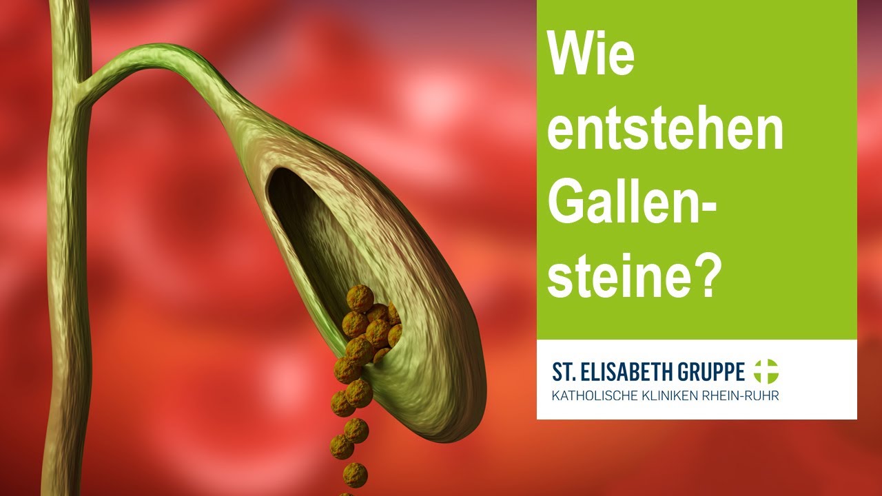 Wie entstehen Gallensteine? - YouTube