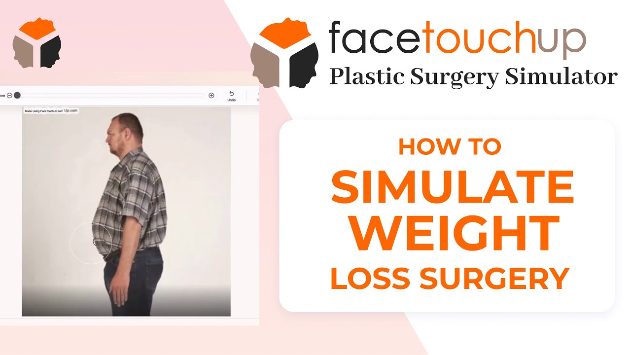 How to use FaceTouchUp Plastic Surgery Simulator to simulate Bariatric ...