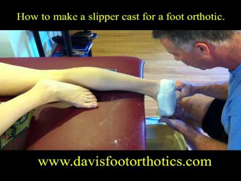 How to make a slipper cast for a foot orthotic - YouTube