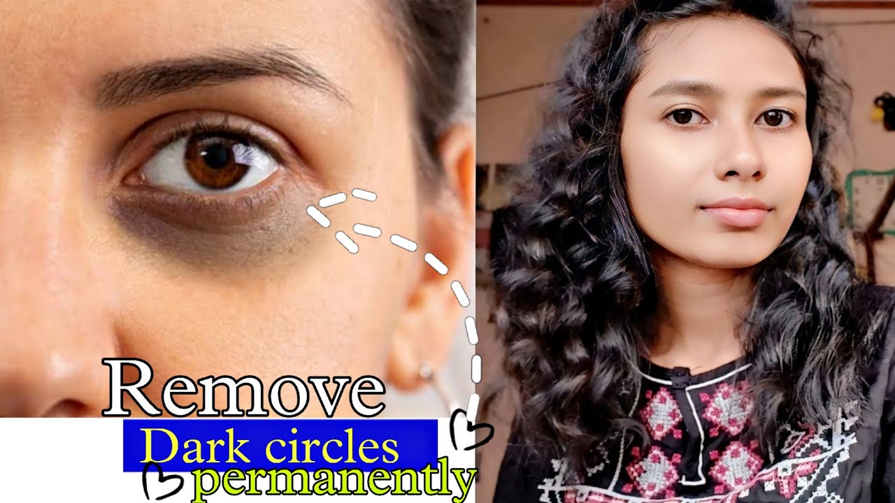 Remove dark circles permanently in just 10 days | get rid of dark ...