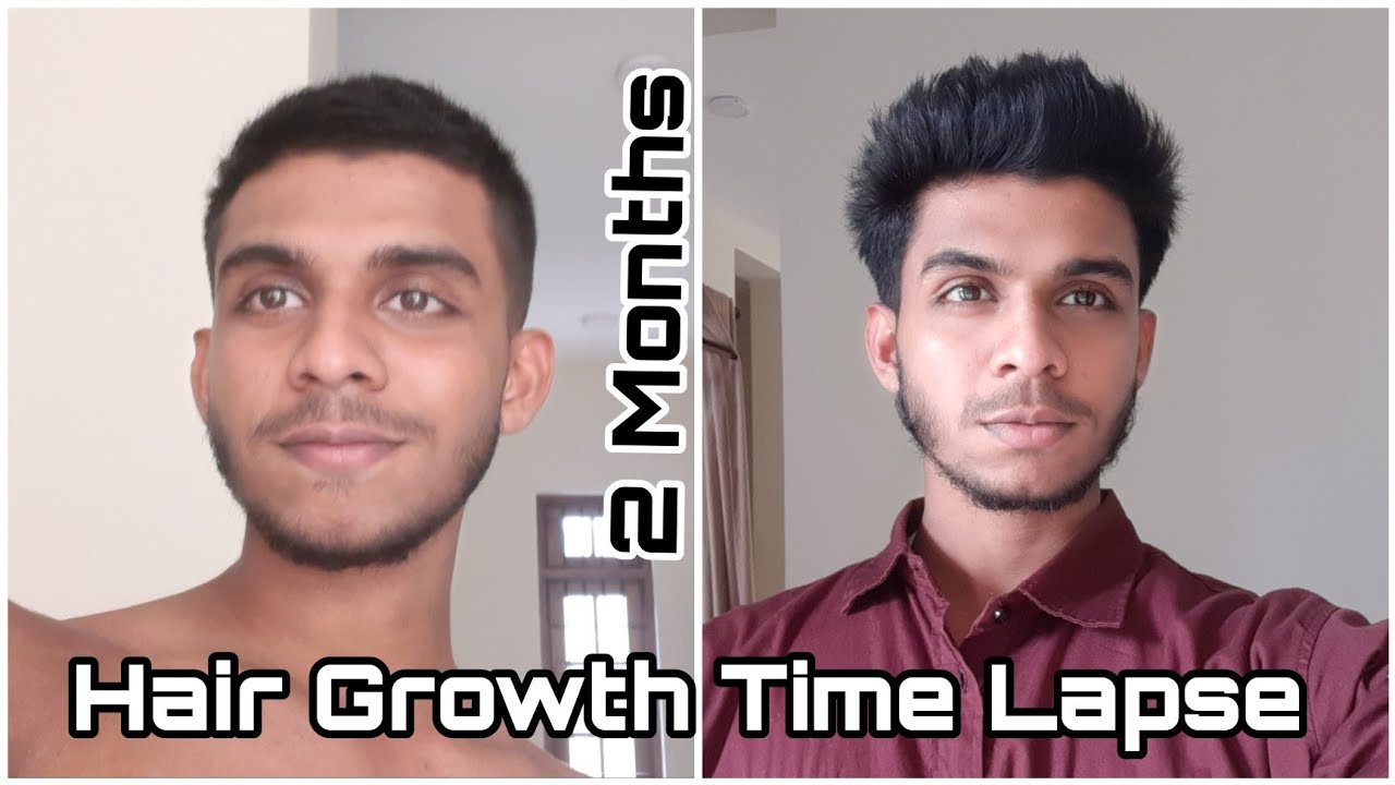 2 Months Hair Growth Time Lapse From Buzz Cut One Photo Per Day # ...