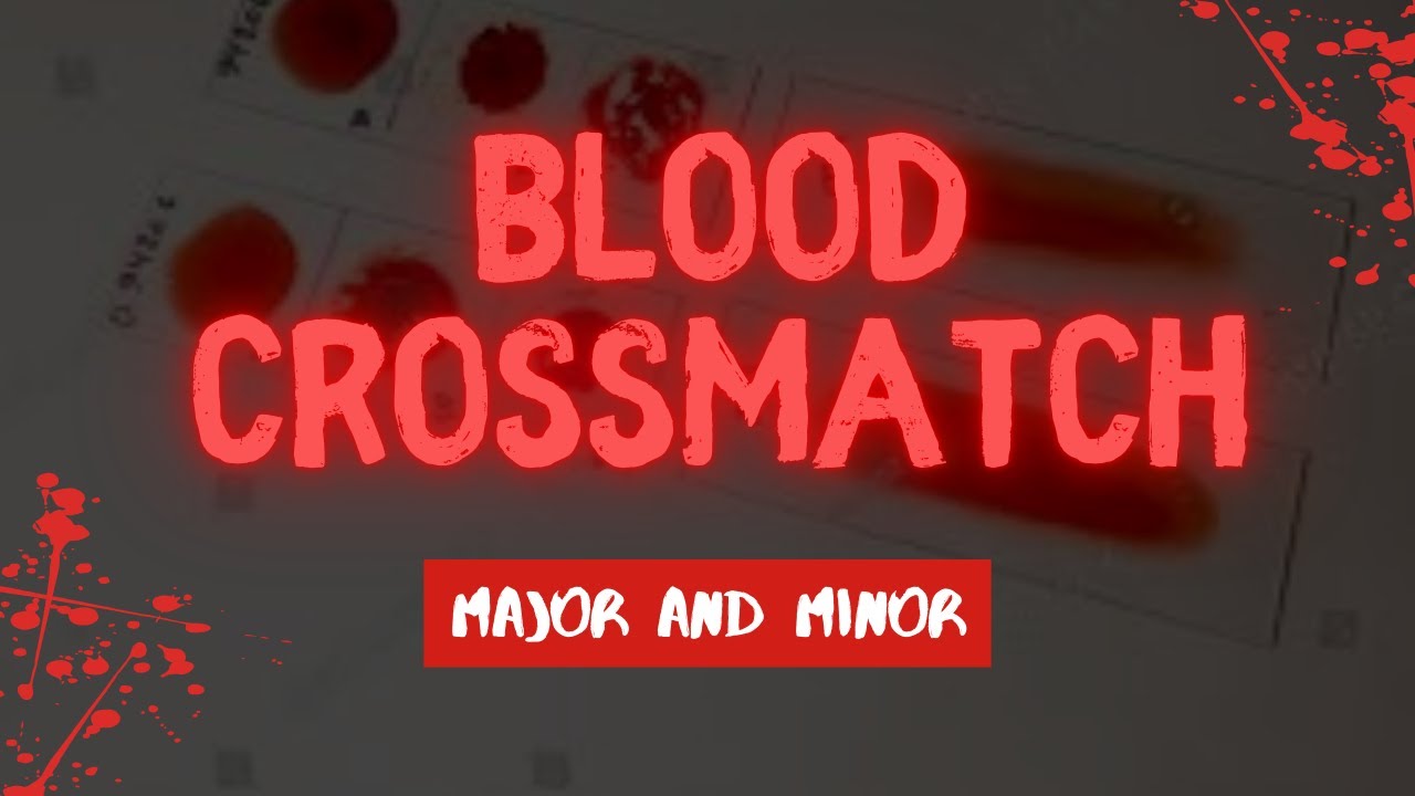 BLOOD CROSSMATCH PROCEDURE (4 TUBE METHOD) - YouTube