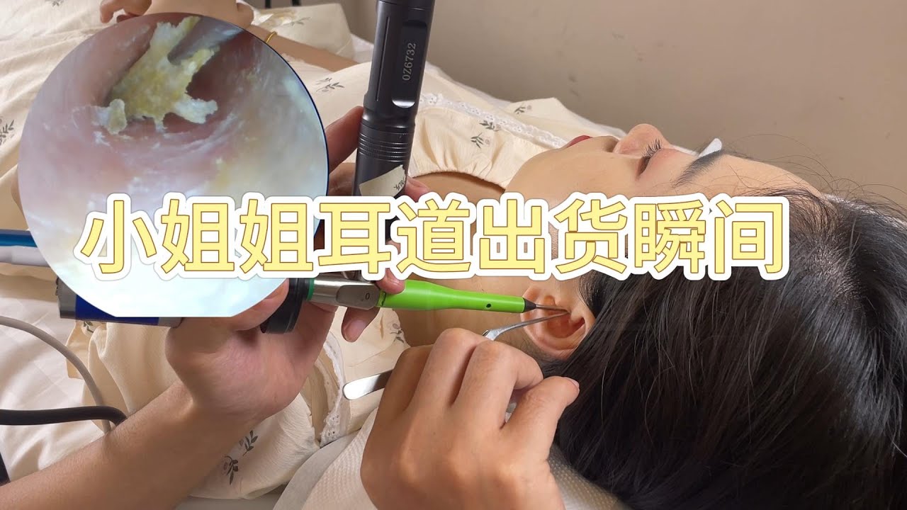 Instant Earwax Removal/Visible Ear Cleaning - YouTube