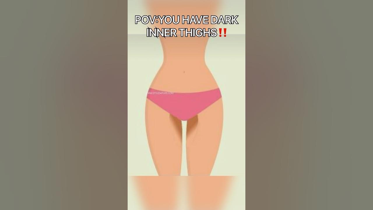Do You Have Dark Inner Thighs Skincareroutine Skincare Shots Shortstrendingshorts Youtube