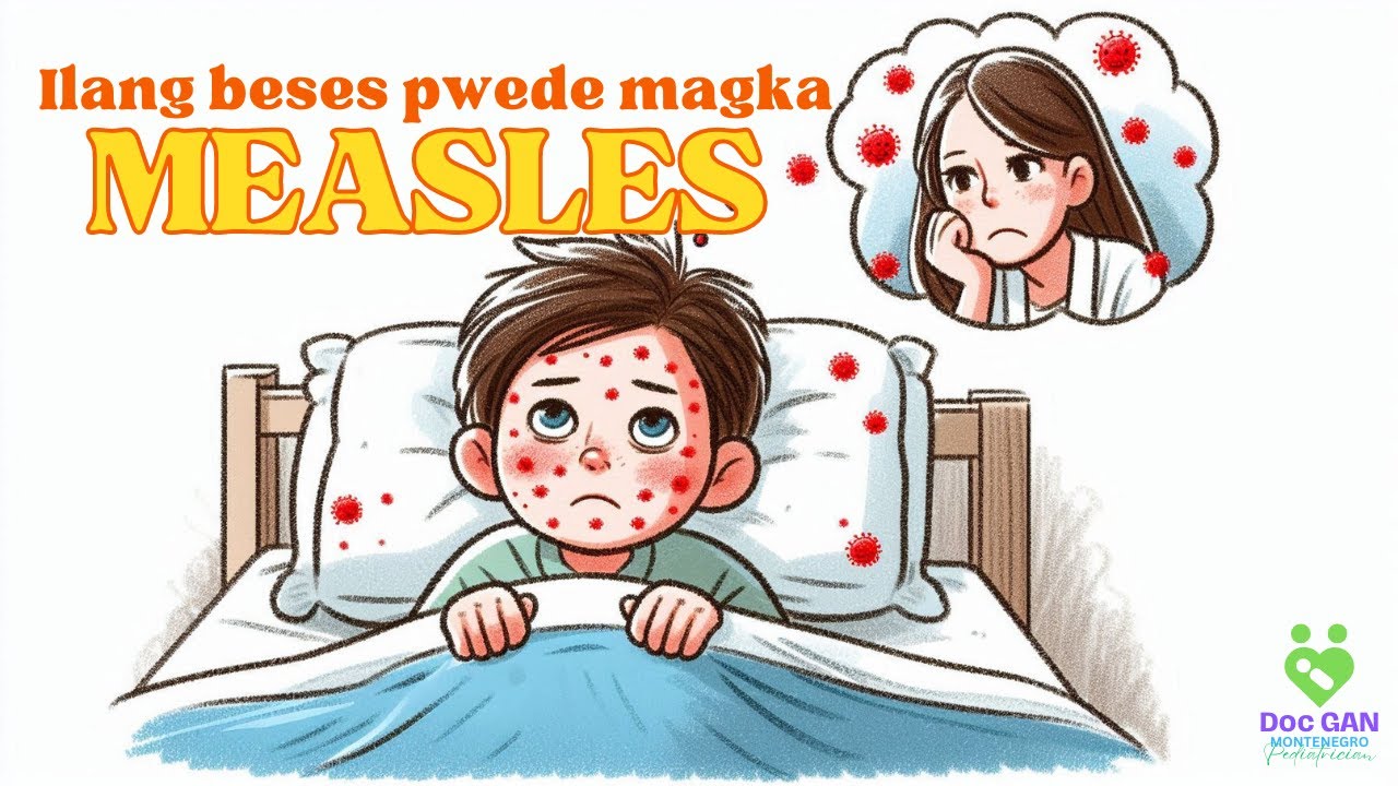Ilang beses pwede magka MEASLES (Tigdas)? | AskDocGan - YouTube