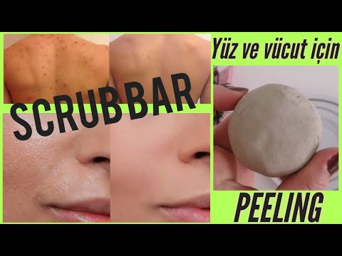 10 dəqiqə ərzində dərinizdəki yağlı görüntüdən qurtarın! QARAMAQ VƏ DÜZDƏK DƏRİ alın!