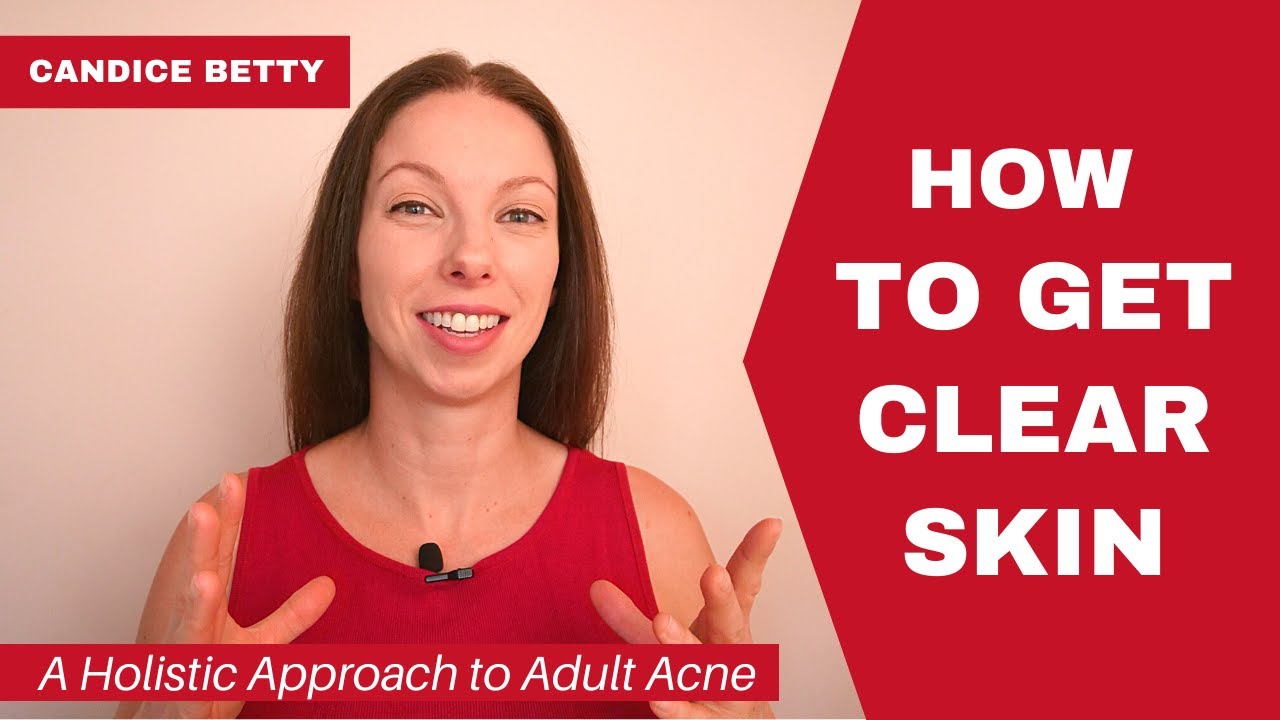 How To Get Clear Skin A Holistic Approach To Prevent Adult Acne Youtube