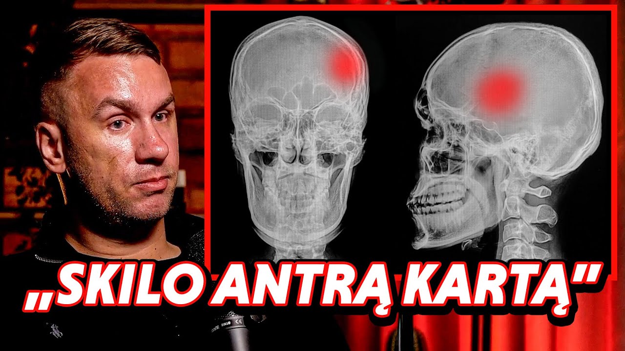 Dar viena Andriuškevičiaus galvos trauma apie kurią niekas nežinojo ...