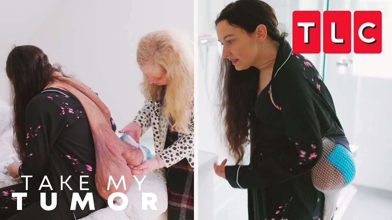 Alexandra's 20-Pound Neck Tumor | Take My Tumor | TLC - YouTube