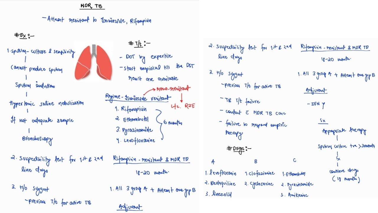 MDR TB NOTES | ONE PAGE NOTE | RESPIRATORY | MEDICINE | 4TH PROFF ...