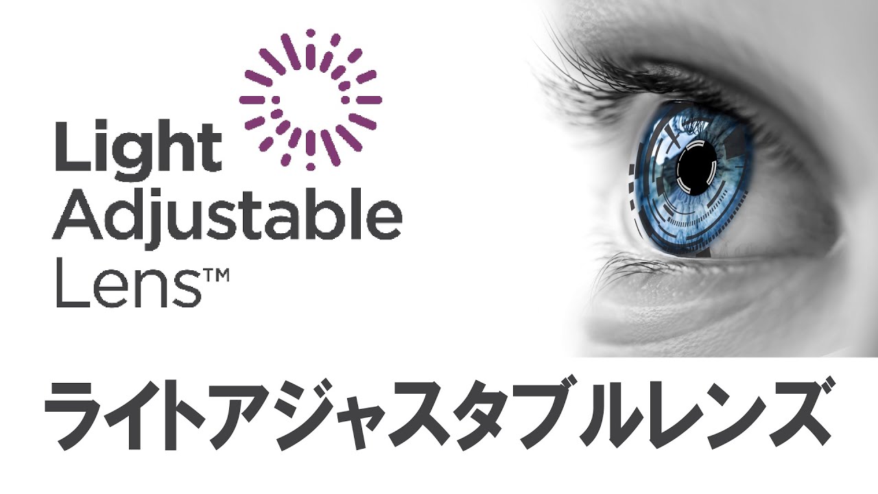 画期的な白内障眼内レンズ：ライトアジャスタブルレンズ RxSight社製 Light Adjustable Lens｜名古屋市｜中京眼科 ...