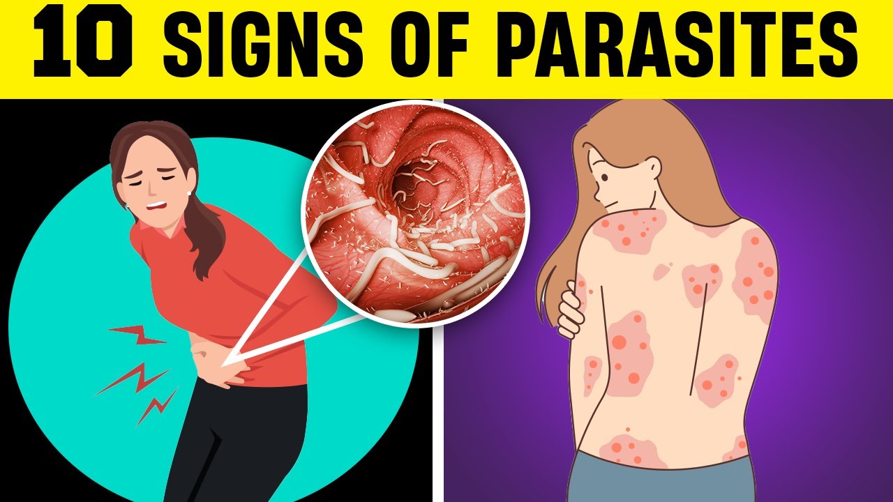 10 Signs of Cancer-Causing Parasites that 90% of People Ignore - YouTube