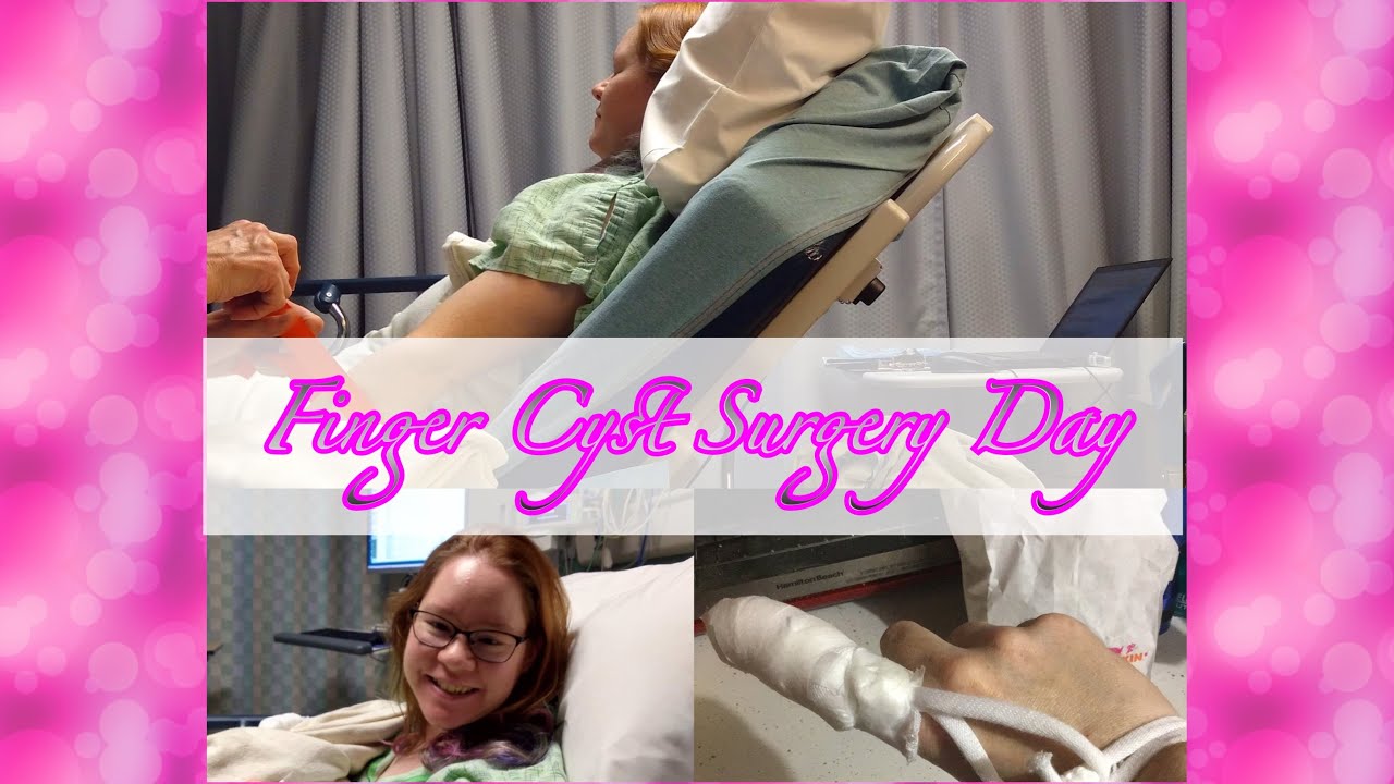 Finger Cyst Surgery Day - YouTube