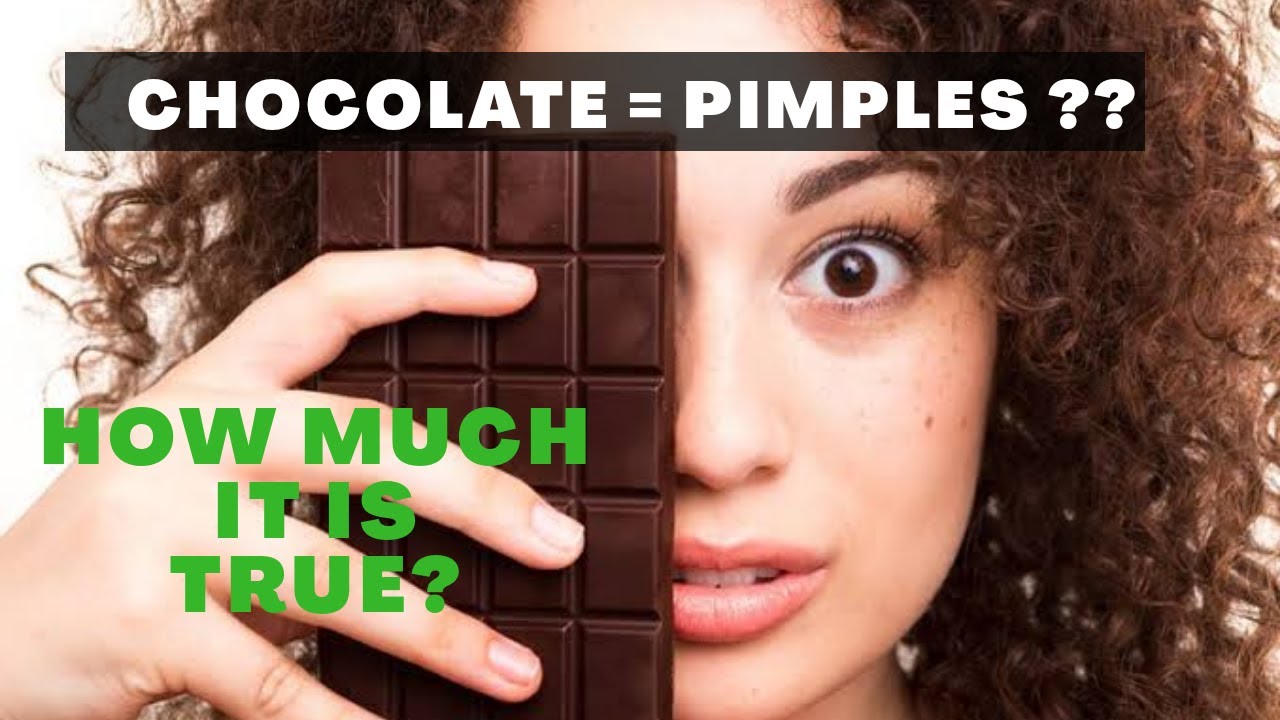 Does chocolate causing pimples ton you ? Know this time how much it is ...