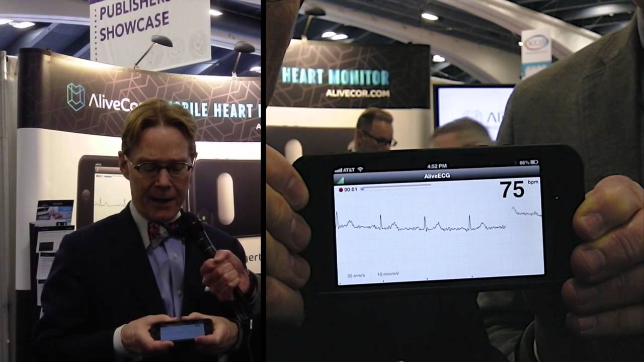 ECG on Your iPhone - Mobile Heart Monitor - YouTube