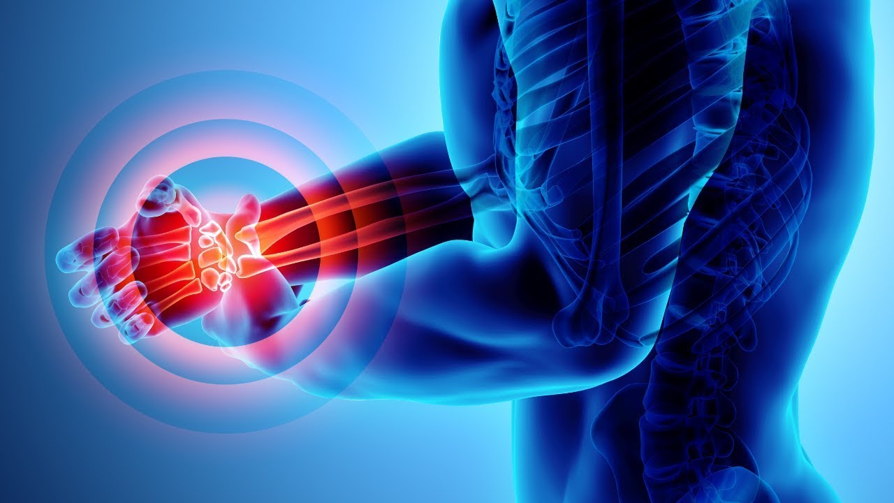 How To Fix A Repetitive Strain Injury RSI YouTube How To Fix A Repetitive Strain Injury RSI YouTube