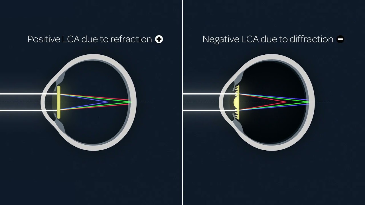How to correct longitudinal chromatic aberration (LCA) ? - YouTube