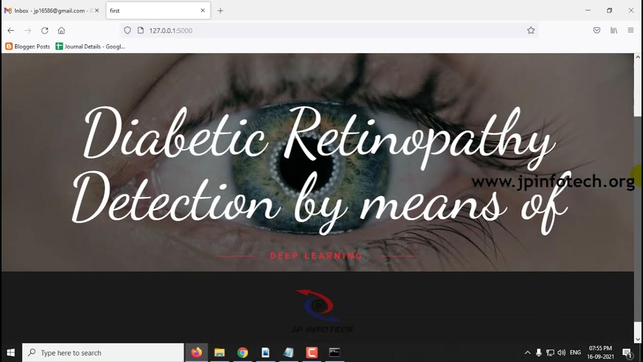 Diabetic Retinopathy Detection by means of Deep Learning | Python Final Year IEEE Project - YouTube