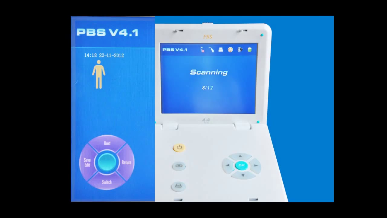 Palm Bladder Scanner - Mianyang Meike, China - YouTube