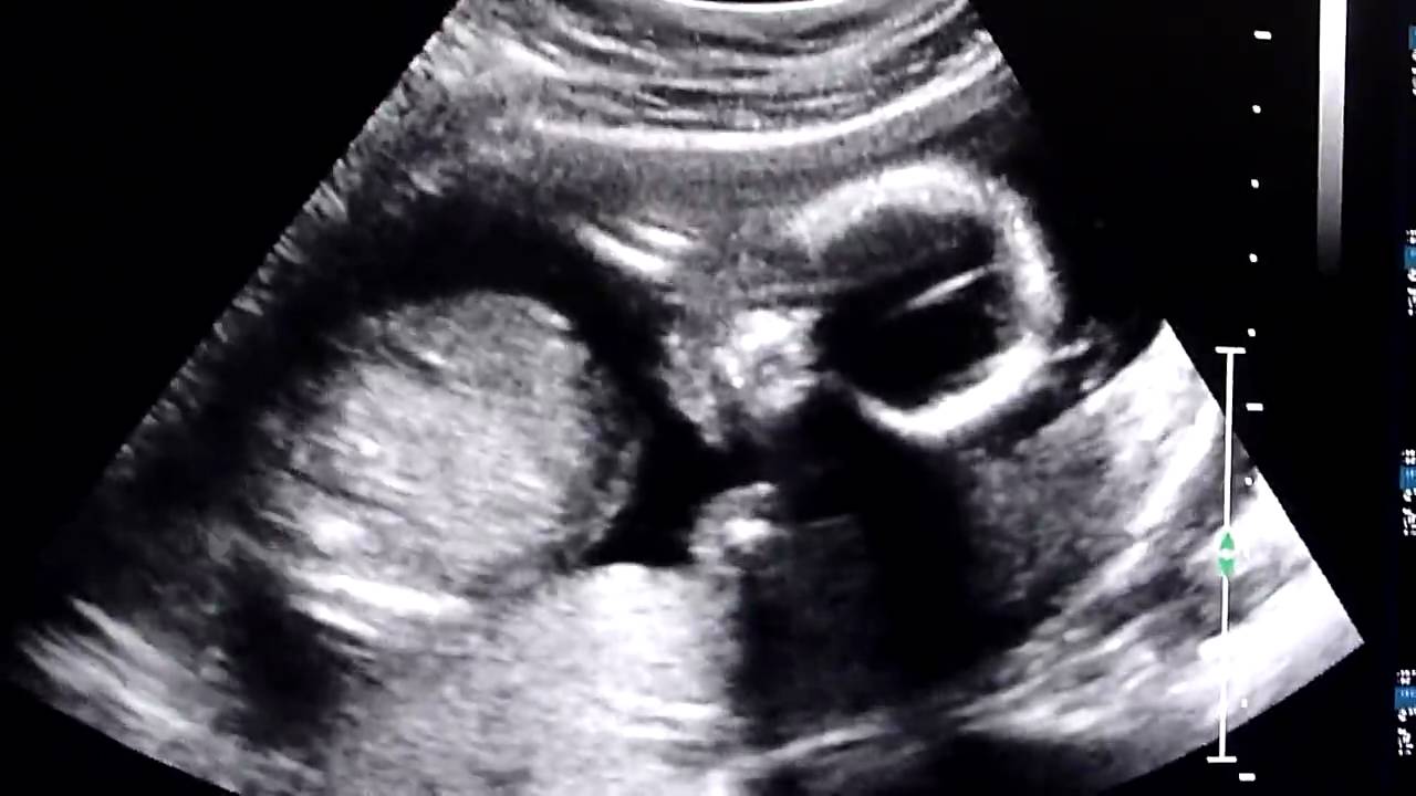 Baby Waves Hello - YouTube