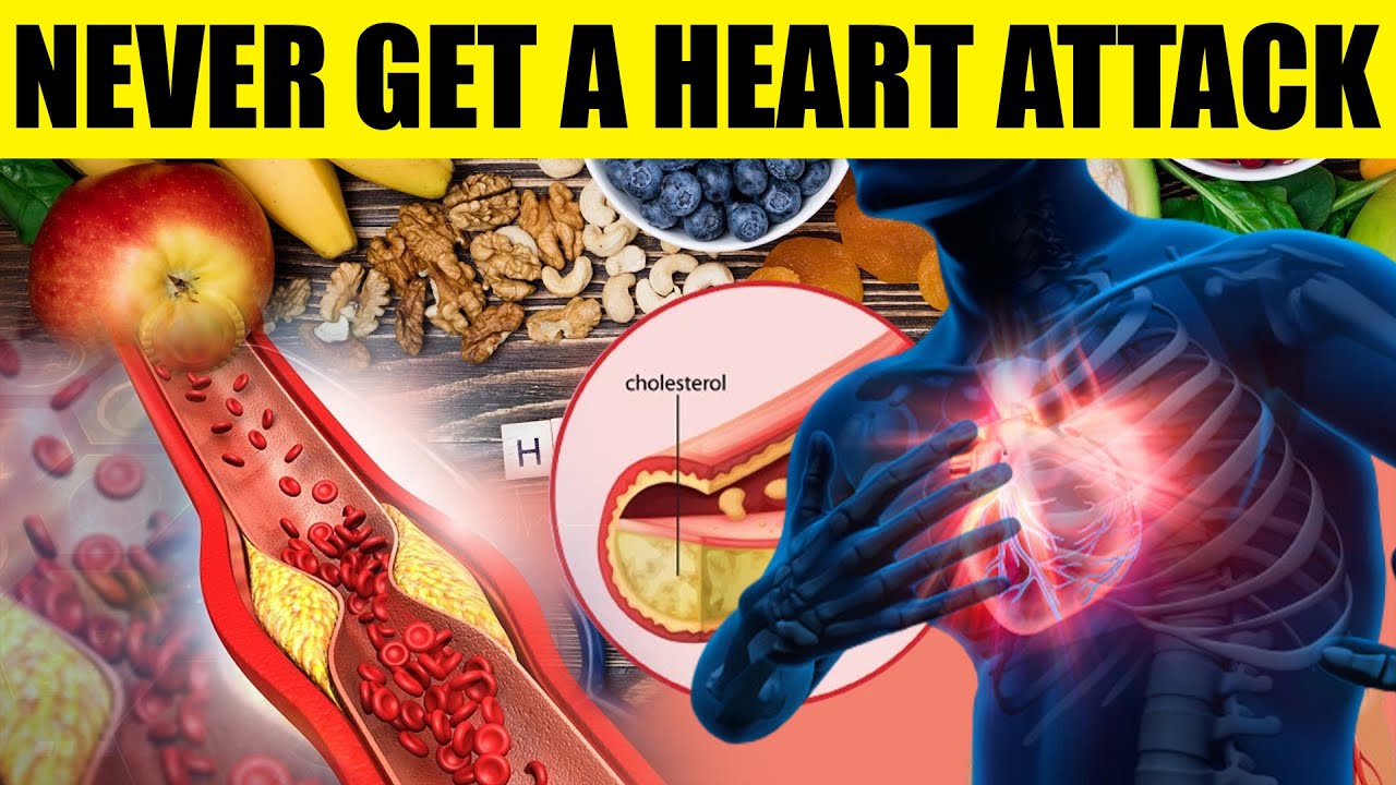 You'll Never Get a Heart Attack If You Eat These 12 Arteries Cleansing ...
