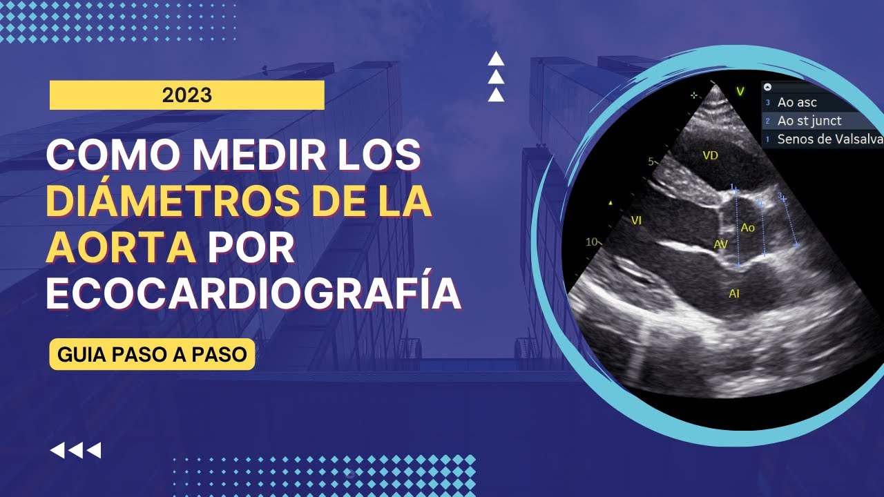 🤓[Como medir] los 🎯DIÁMETROS DE LA AORTA por ECOCARDIOGRAFÍA: Guía paso ...