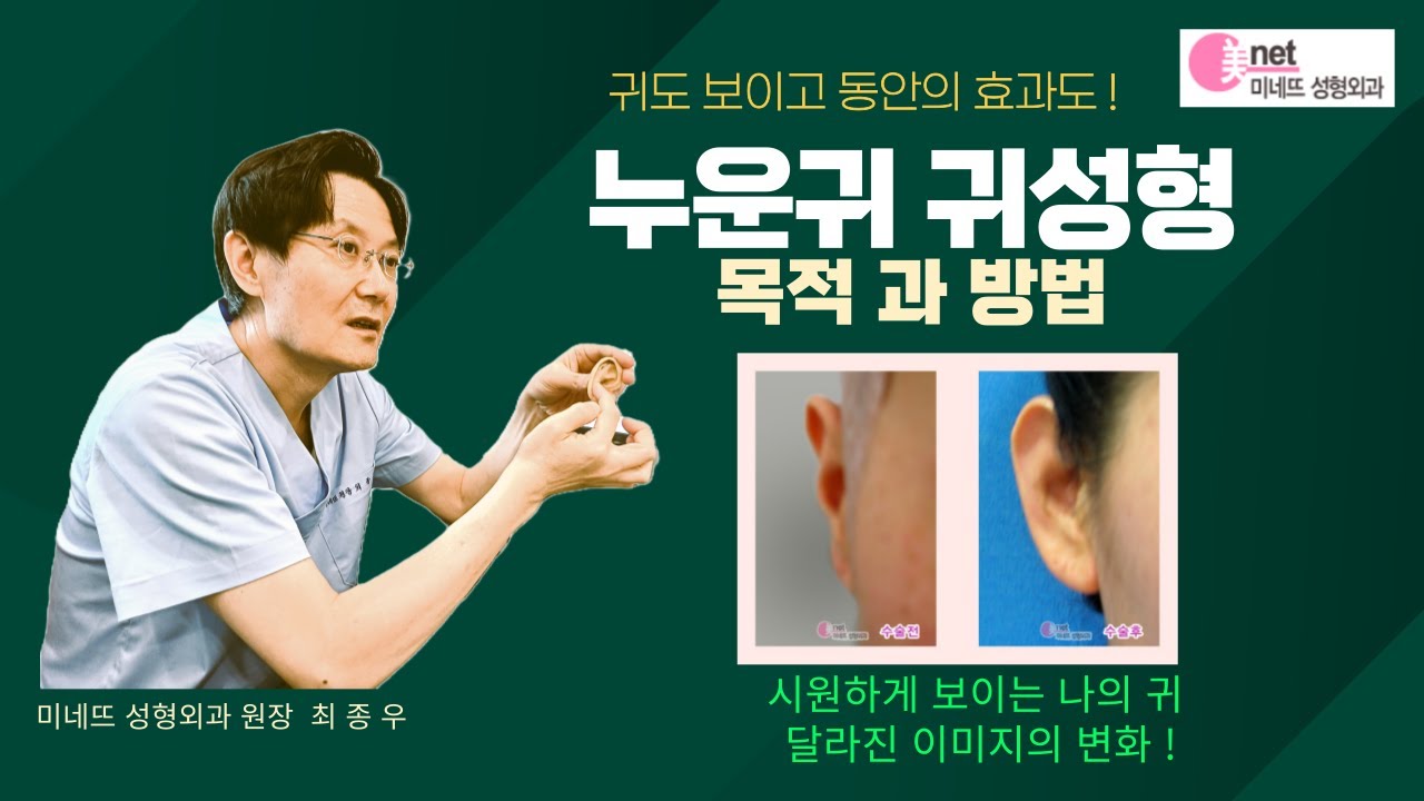 누운귀 귀성형 목적 과 방법 #누운귀성형 - YouTube