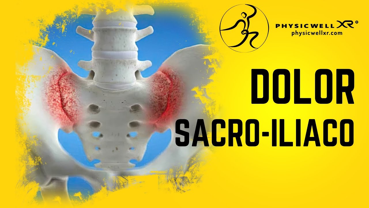 Dolor SACRO-ILIACO - YouTube