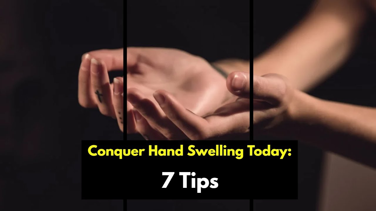 SWELLING IN THE HANDS AND FINGERS 👌: 13 MAIN CAUSES (AND WHAT TO DO) 🔥 ...