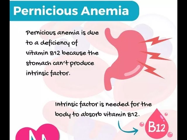 What Is Pernicious Anemia And What Causes It