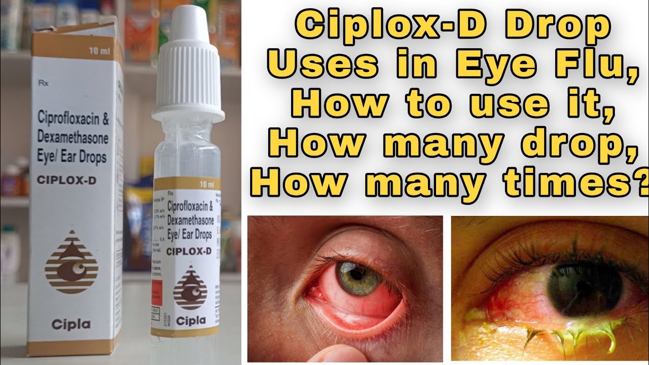 Ciplox-D drop uses in Eye flu and Eye infection | Ciprofloxacin and ...