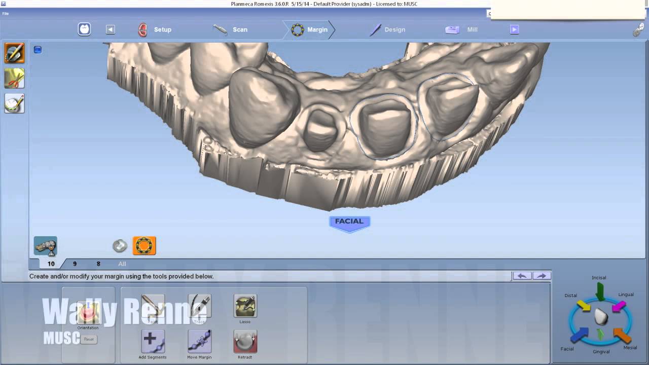 Planscan E4D CAD/CAM Case Planmeca FIT - YouTube