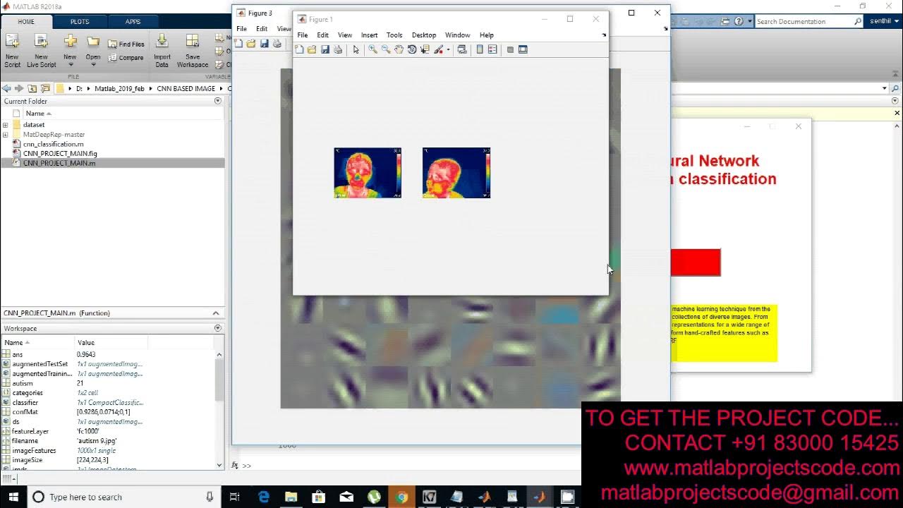 Autism Classification from face heat images using convolution neural network CNN | Autism ...