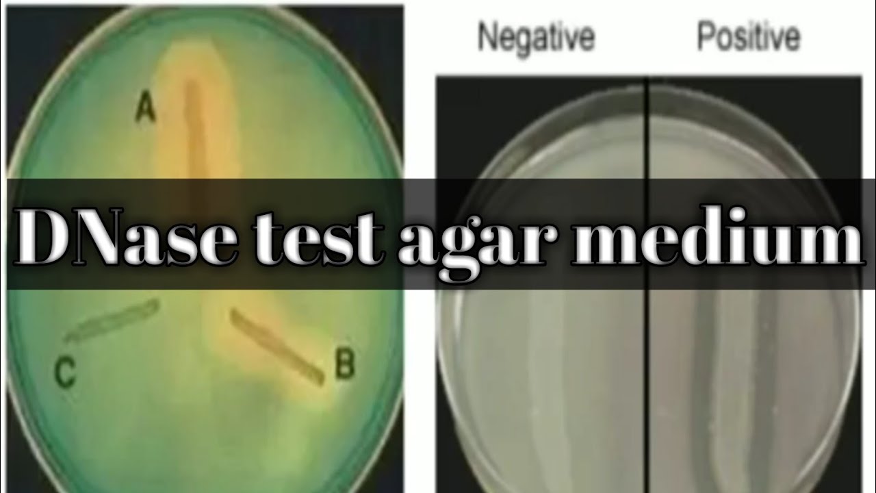 DNase test: biochemical test lecture 15 - YouTube