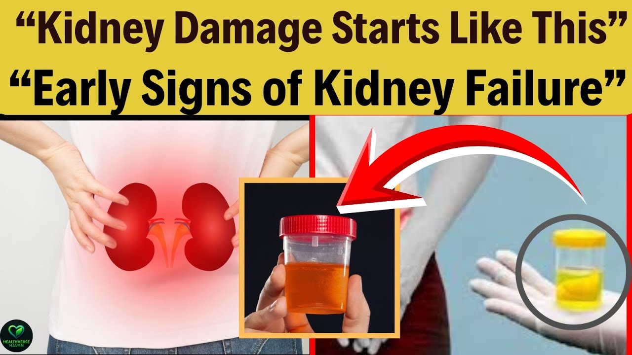 Early Symptoms of Kidney Damage You Should Never Ignore Healthverse ...