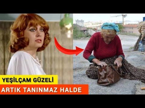 Ekranların Unutulan Ünlüleri Artık Tanınmaz Haldeler!