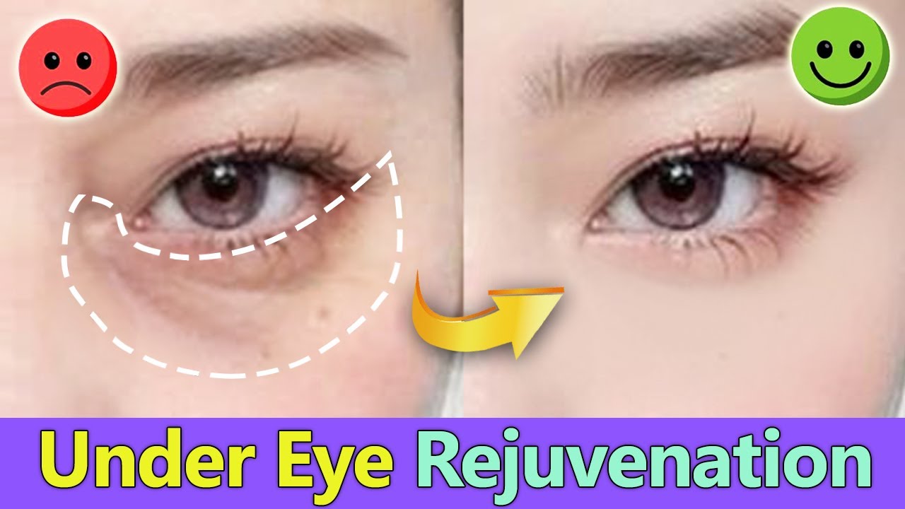 4 Mins Eye Exercises for Tear Trough Filler, Fix Sunken Eyes, Under eye ...
