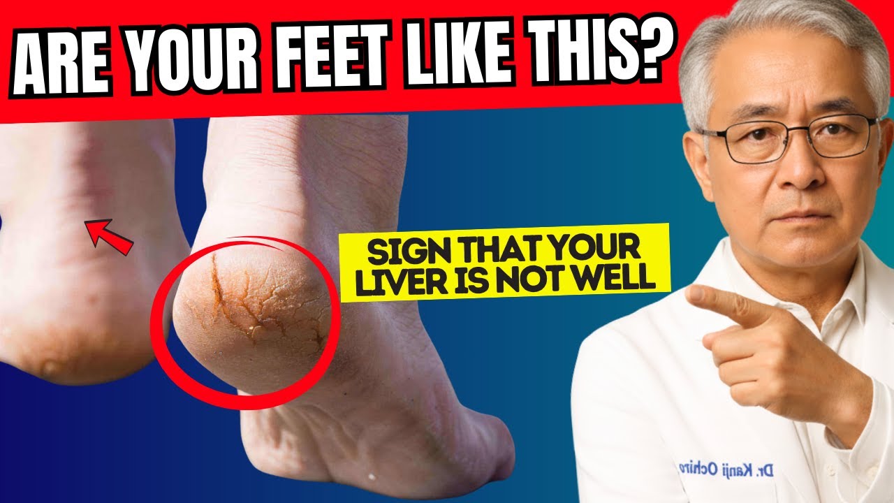 7 Foot Signs Indicate LIVER PROBLEMS Pay Attention! - YouTube