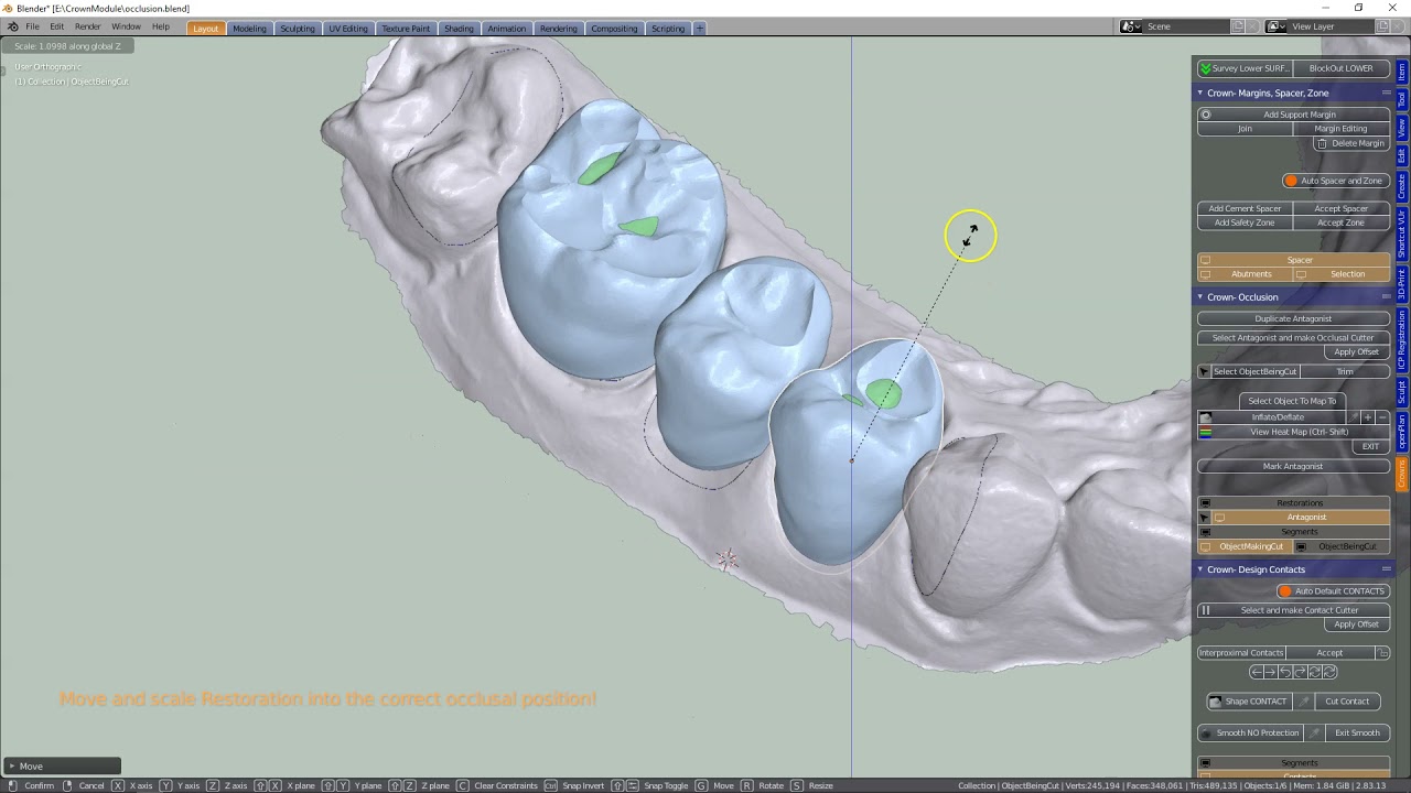 B4D Dental Modules- Crown Module - YouTube