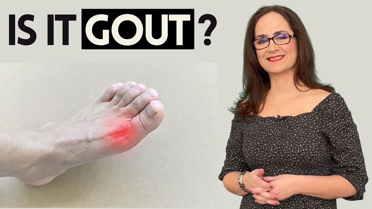 #082 Gout - Everything You Need to Know - YouTube