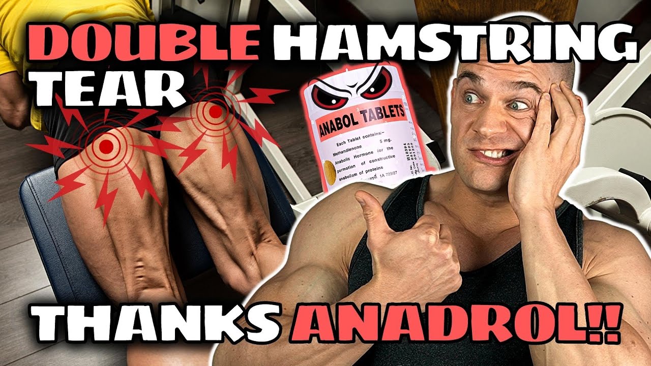 How Steve Tore BOTH Hamstrings Running Anadrol Pre-Workout! Vigorous ...