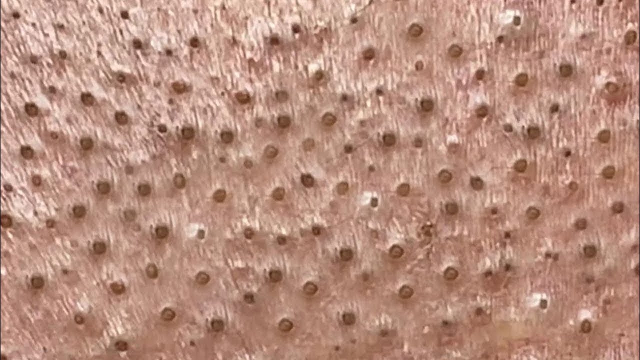 ESPREMENDO CRAVOS GIGANTES SATISFATÓRIO DEMAIS 25 - YouTube