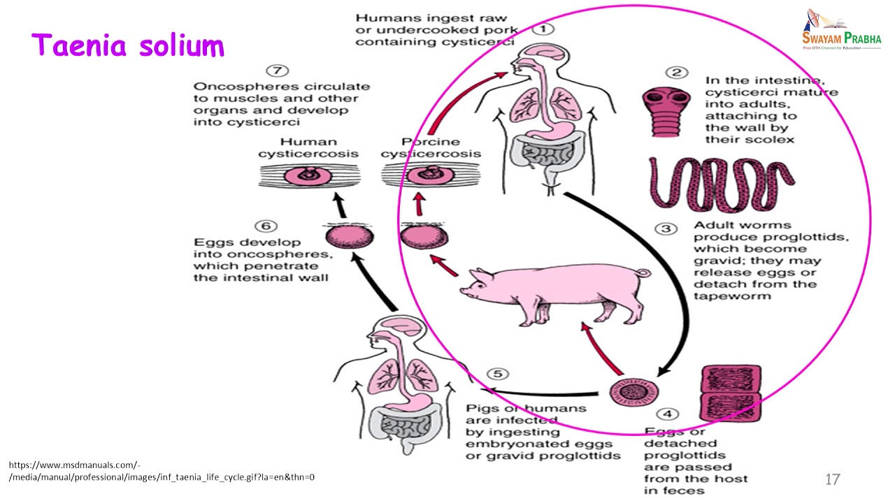 33. Parasitic infestations:Cestodes - YouTube