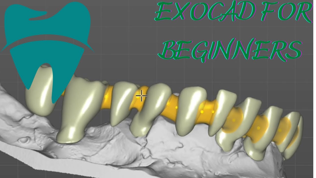 Fastest Exocad Video Tutorial - Full Arch under 20 minutes - YouTube