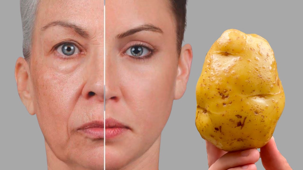 Shocking 😮She Wiped the Dark Spots Off Her Face with Potatoes and ...