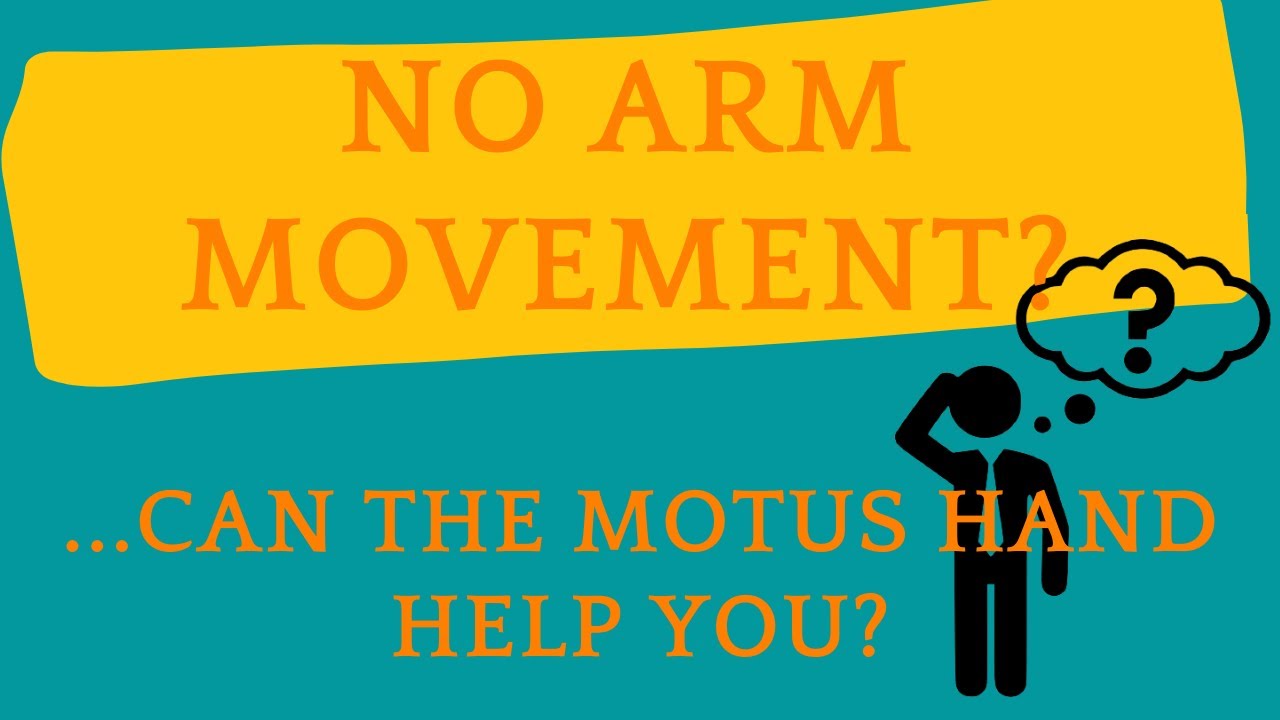 With no movement in Arm, does the Motus Hand help you? - YouTube
